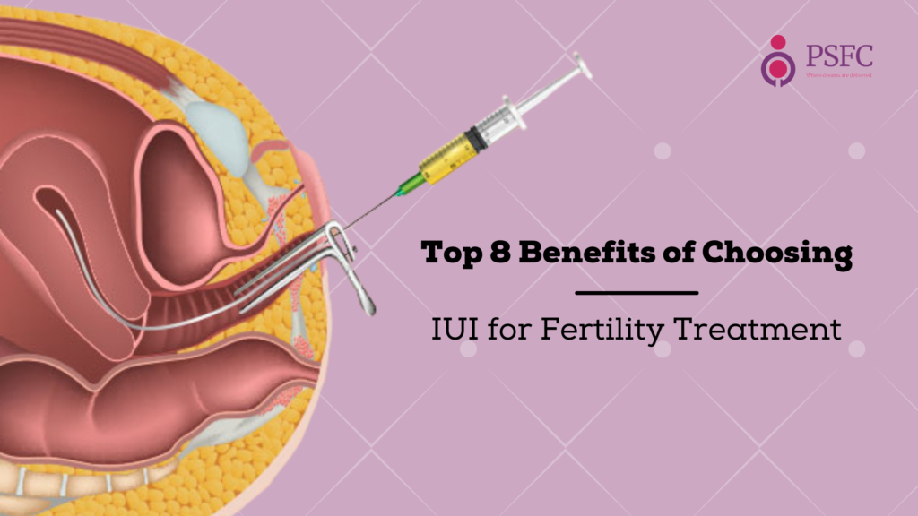 Top 8 Benefits of Choosing IUI for Fertility Treatment - Pearl ...